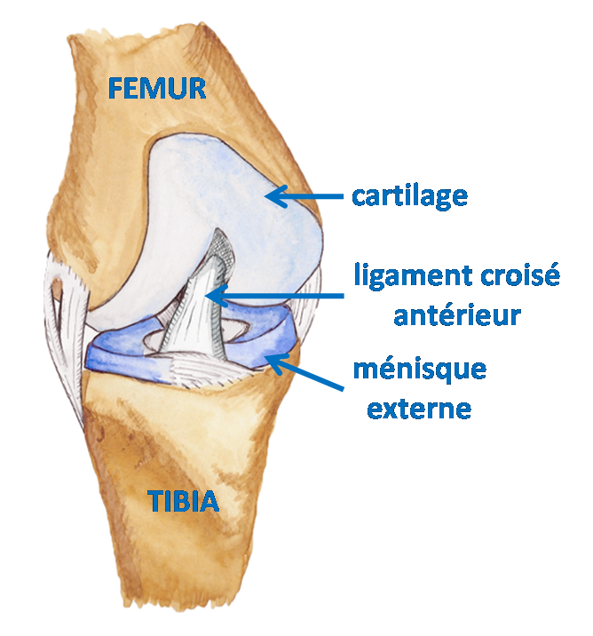 ligamentoplastie ligament croisé antérieur – Dr Felden – réunion – 974